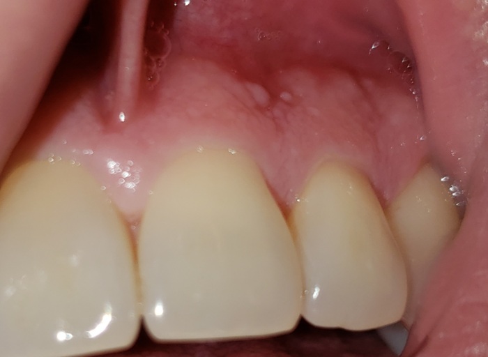 What s Causing This Pain In My Gums what-s-causing-this-pain-in-my-gums
